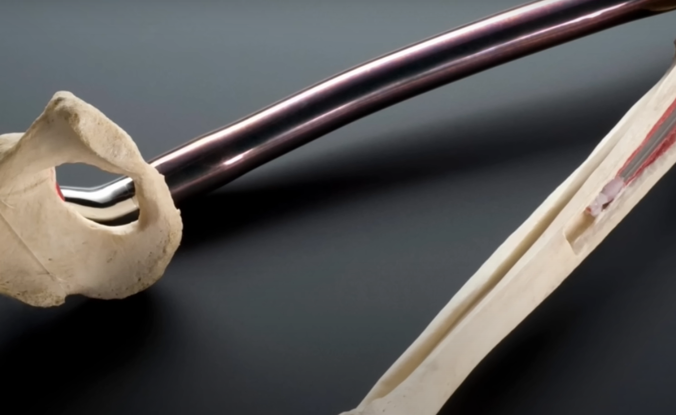 What Is 300M Steel? - MetalProfy